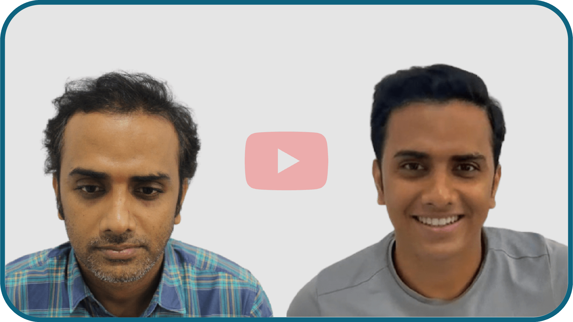 Best Hair Transplant Clinic in Lucknow | Hair Transplant Surgeons